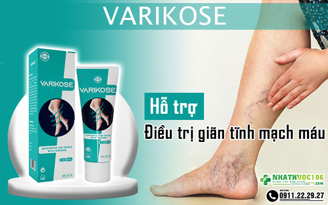 Kem bôi Varikose có tốt không? mua ở đâu chính hãng? giá bao nhiêu?